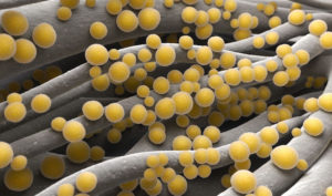 How Do You Know if You Have MRSA In Your Urine? - Health Report
